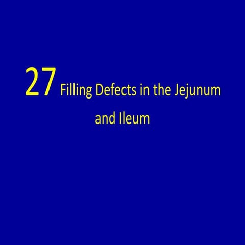 27 filling defects in the jejunum and ileum | PPTX