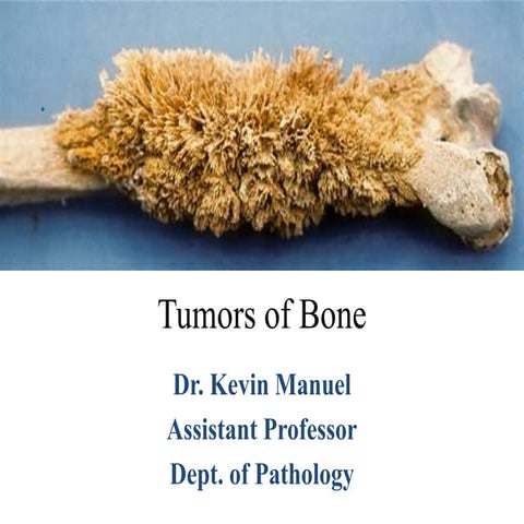 Tumors of bone | PPTX