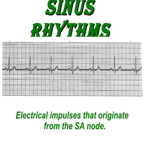 Sinus Rhythms - BMH/Tele | PPT