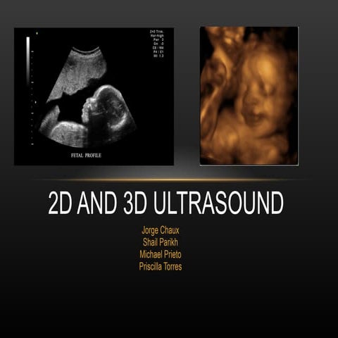 2 d and 3d ultrasound | PPT