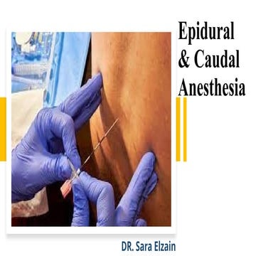 Spinal & epidural needle | PPTX