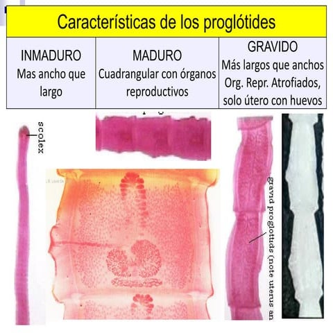 Parasitologia clase eucestoda de phylum platyhelmintes de genero ...