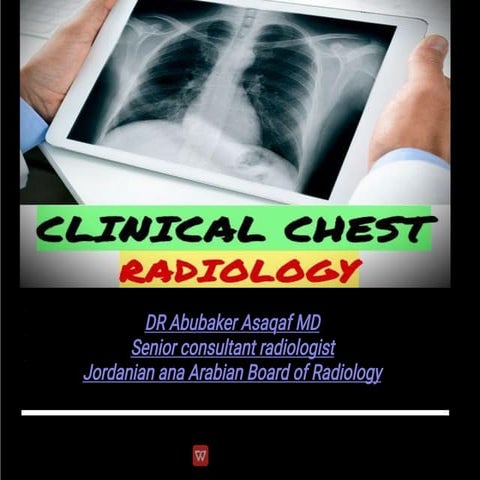 Chest xray -Lateral view radiology basics | PDF