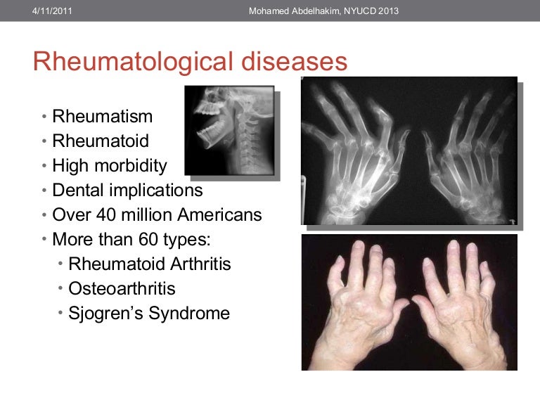 rheumatological diseases