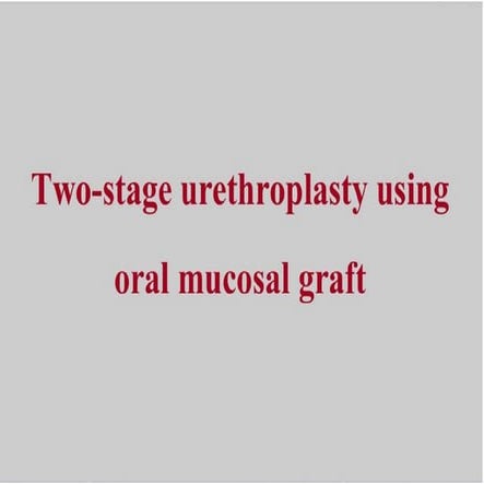 Hypospadias 3: MAGPI & snod grass (TIP) step by step operative urology ...