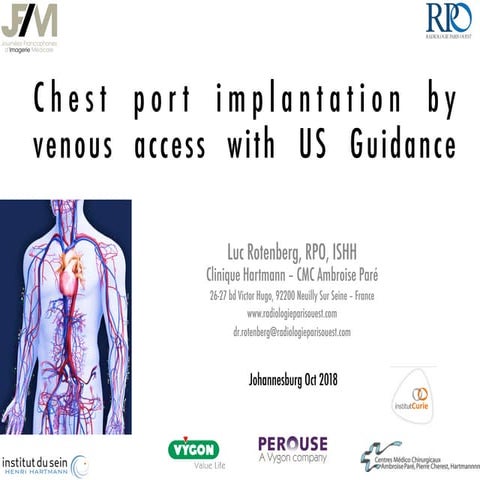 US Guidance venous access puncture in chest port imlantation . Luc ...