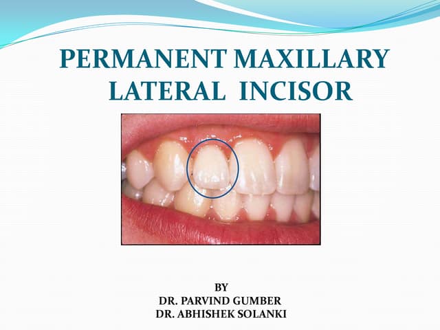 Maxillary central incisor (ORAL ANATOMY) | PPTX