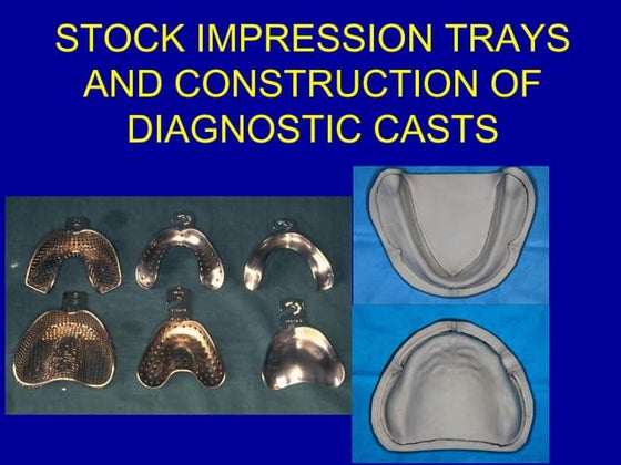 Impression Trays (PPT).pptx