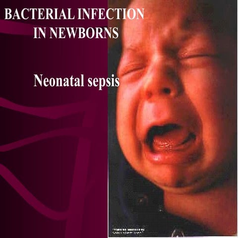 Bacterial infection in Newborns.Neonatal sepsis | PPT