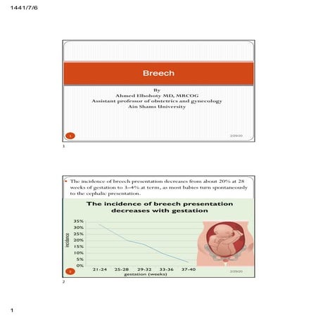 Ecv- External Cephalic Version- Define, Risk, procedure, step, benefits ...