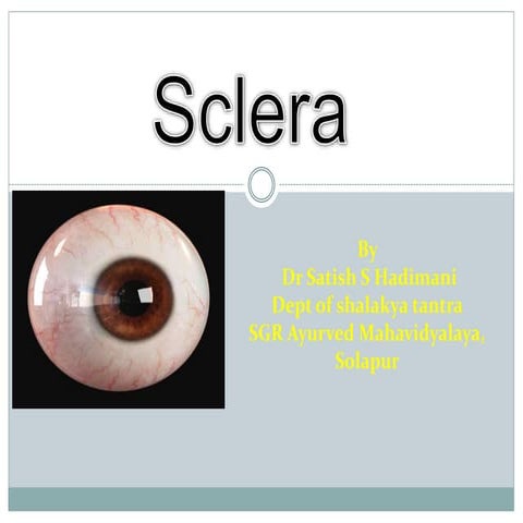 Diseases of sclera
