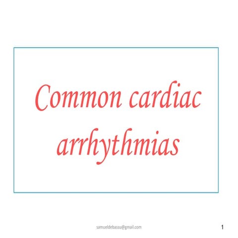 3. common cardiac arrythemias | PPTX