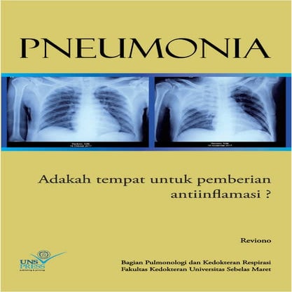 3. pneumonia.pdf