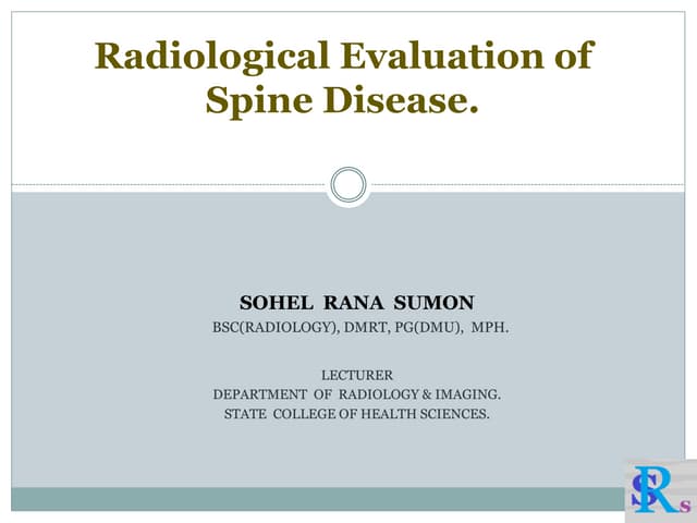 Transitional vertebrae radiology | PPTX