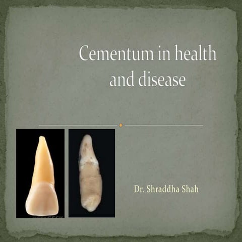 Cementum | PPT