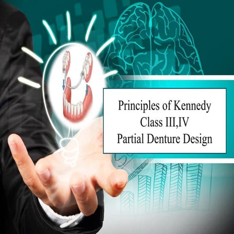 3.Principles of kennedy class III IV RPD design2025.pptx