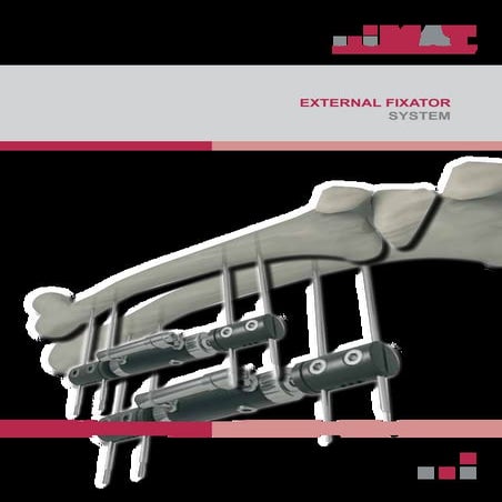 3 brochure external-fixators | PDF | Bone and Joint Conditions ...