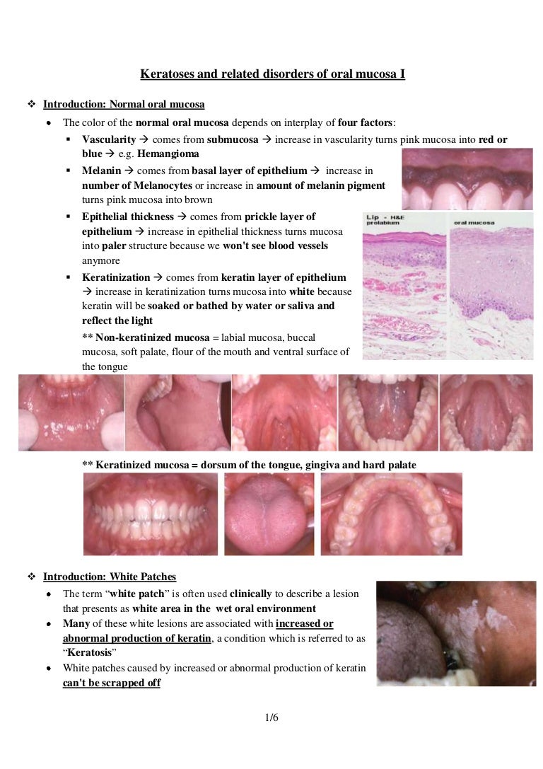3 keratoses and related disorders of oral mucosa i