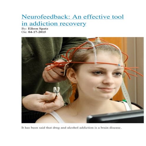 Neurofeedback | PDF