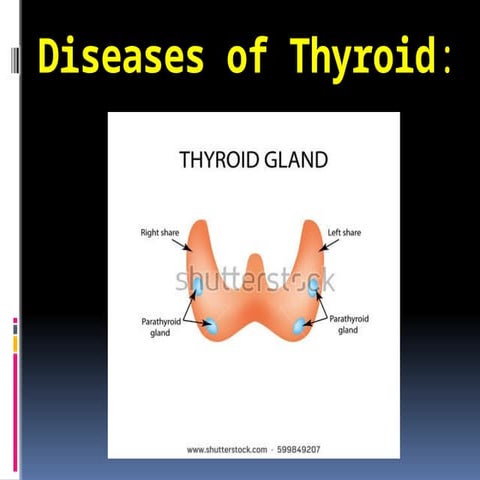 31. Diseases of Thyroid ushshdjdhdjs.pptx