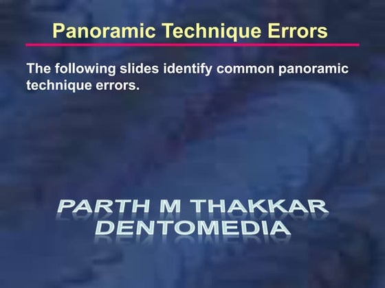 Common errors in opg | PPT