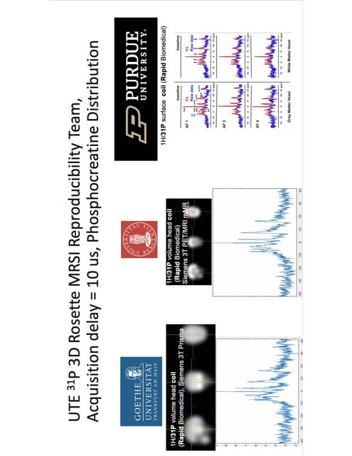 3D UTE 31P-MRSI with modified rosette k-space (PETALUTE): Comparison with conventional weighted ...