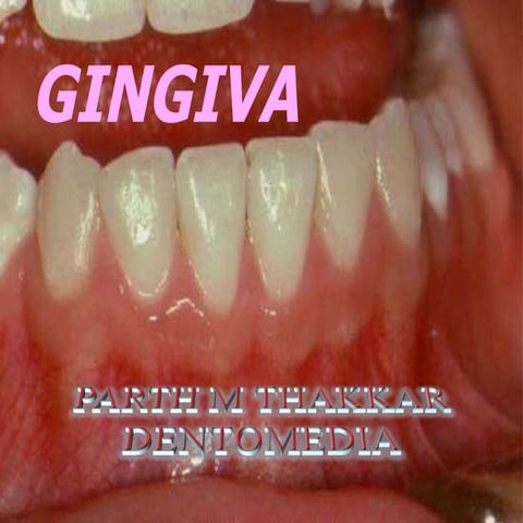 Clinical features of gingiva