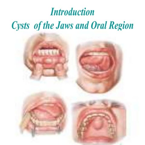 326036820-Introduction-Cysts-of-Jaws.ppt