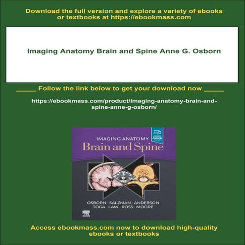 Imaging Anatomy Brain and Spine Anne G. Osborn | PDF
