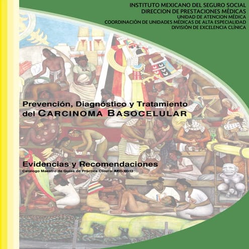 Carcinoma Basocelular | PDF
