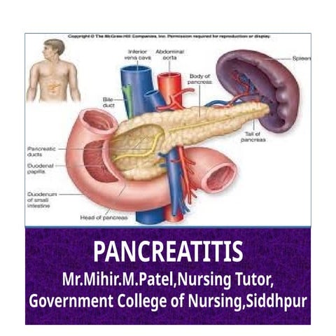 361711086 Pancreatitis Ppt Pptxnnnnnnnnnn Ppt