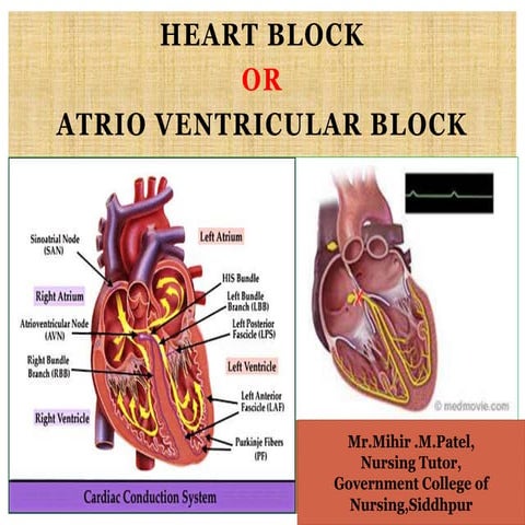361711208-Heart-Block-ppt.pptx