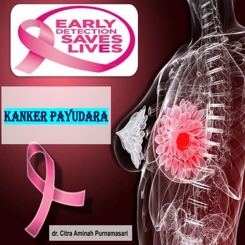 368629235-Presentasi-Kanker-Payudara-pptx-pptx.pptx