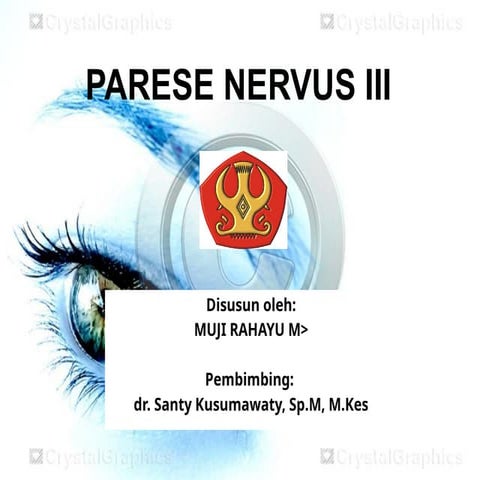 Diagnosis dan Tatalaksana Parese Nervus III | PPTX