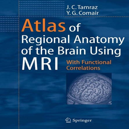 Atlas of Regional ANATOMY of the Brain Using MRI | PDF