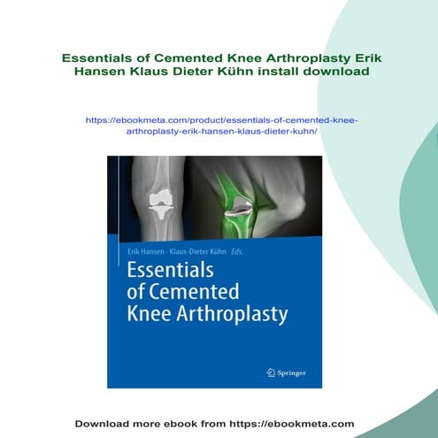 Essentials of Cemented Knee Arthroplasty Erik Hansen Klaus Dieter Kühn ...