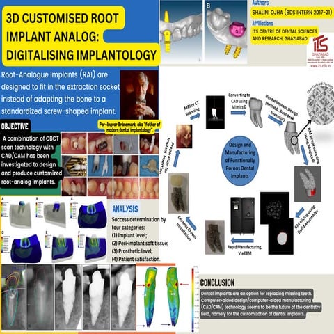 3D CUSTOMISED ROOT IMPLANT ANALOG - DIGITALISING IMPLANTOLOGY.pdf