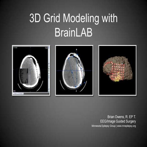 3 D Grid Modeling With Brain Lab | PPTX