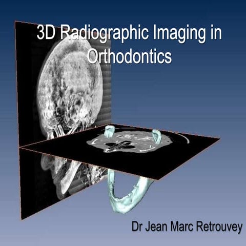 3 D imaging for Orthodontics | PPTX