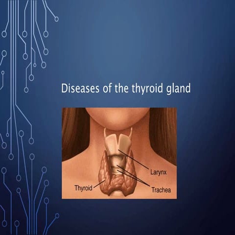 3 Diseases of the thyroid gland (2).ppt