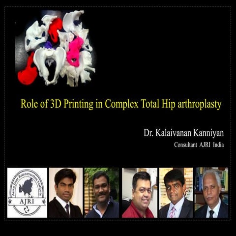 Role of 3D printing & 3D model in Complex Total Hip Replacement | PPTX