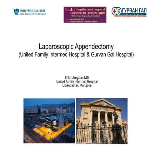 Laparoscopic Appendicectomy- Operative Surgery | PPTX