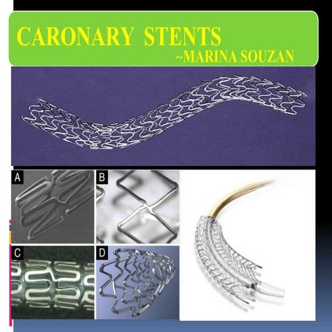 Stents3 | PPTX