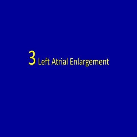 3 left atrial enlargement | PPTX