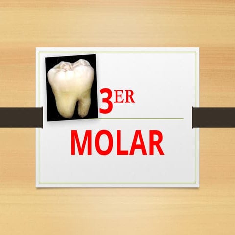 tercer molar anatomia humana tercer molar anatomia humana | PPTX