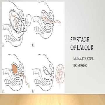 Osce - active management of 3rd stage of labor | PPTX