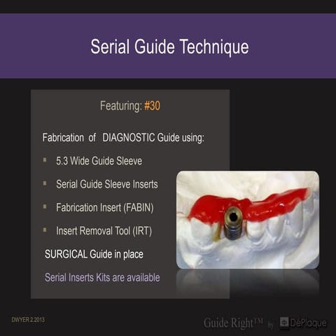Implant placement in the anterior region with simutaneousGBR–surgery ...