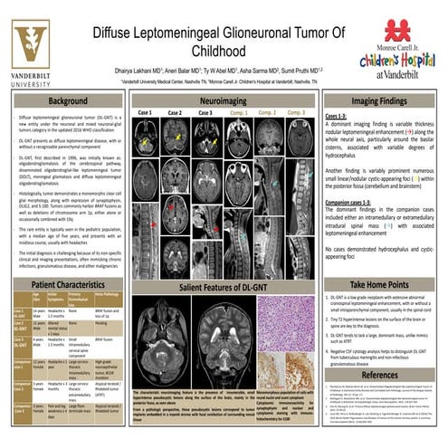 Case series: Diffuse Leptomeningeal Glioneuronal Tumor of Childhood | PPT