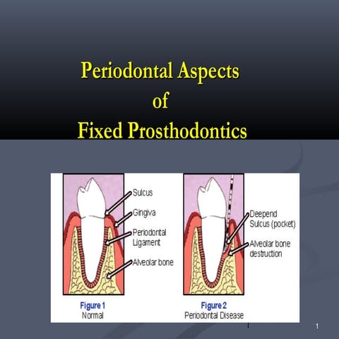 4.n periodontal aspects | PPT