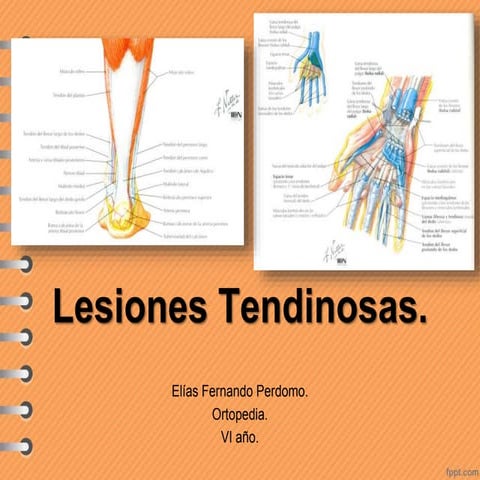 Reconstruccion de lesiones de tendones extensores | PPTX